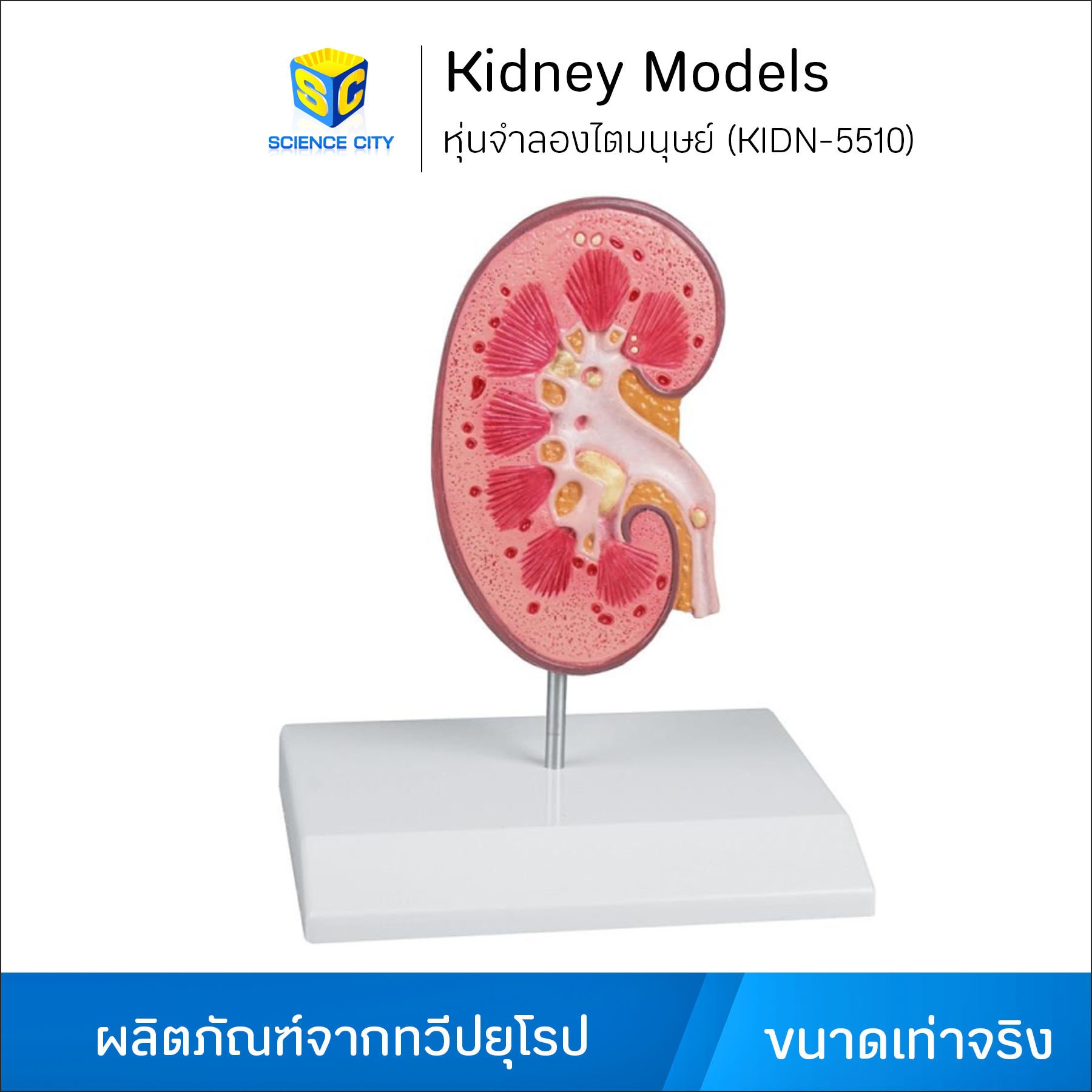 แบบจำลองนิ่วในไต (Kidney Stone Model)