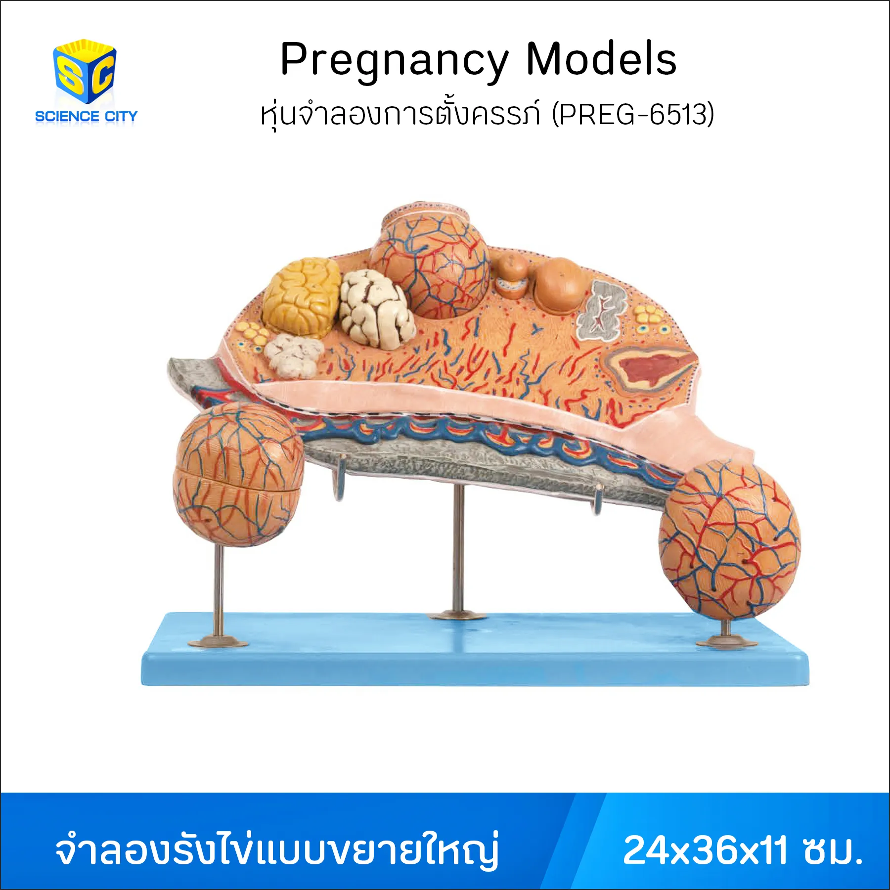 แบบจำลองรังไข่ขยายใหญ่