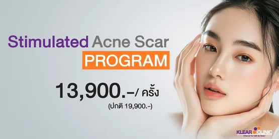 รักษาหลุมสิว-รอยดำ