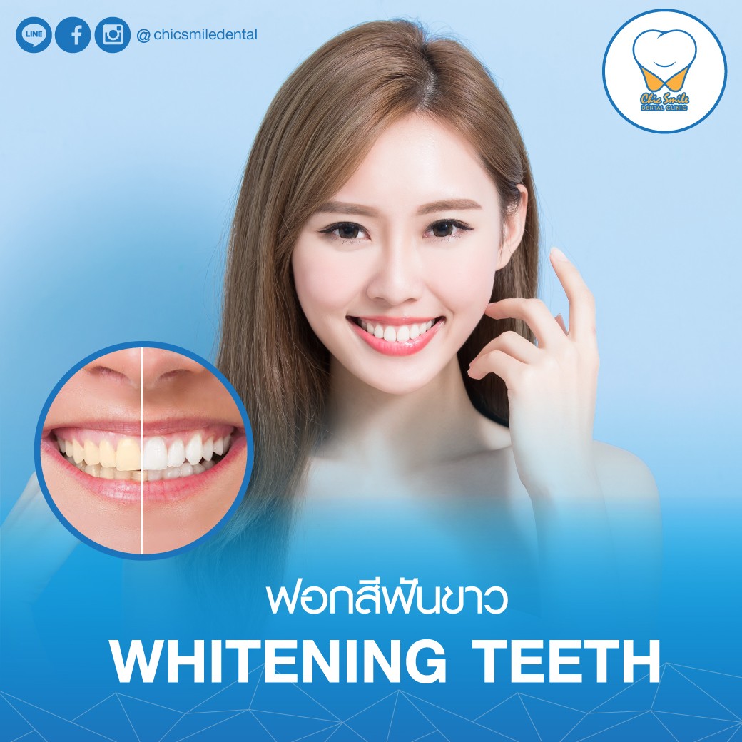 คลินิกทันตกรรมชิคสไมล์ Chic Smile Dental Clinic