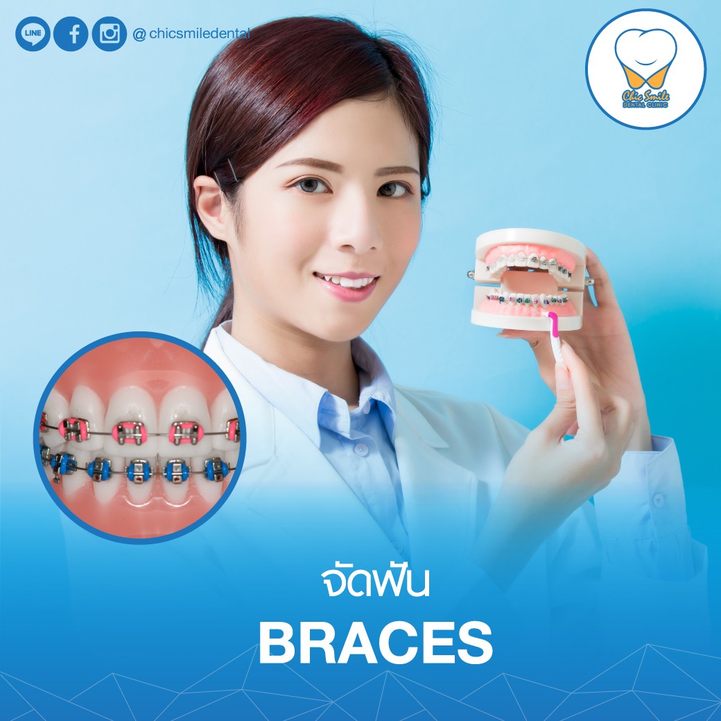 คลินิกทันตกรรมชิคสไมล์ Chic Smile Dental Clinic
