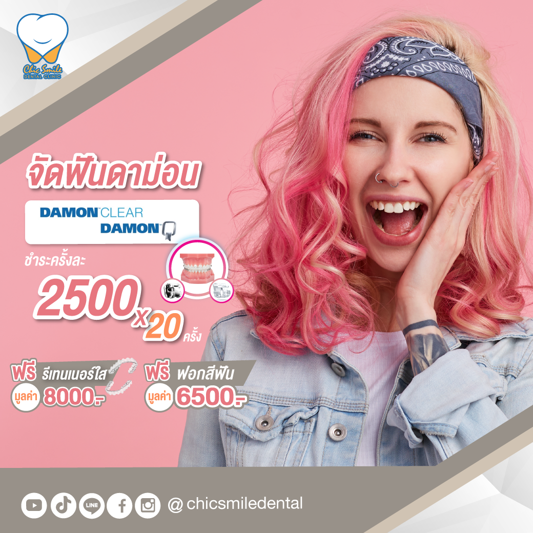คลินิกทันตกรรมชิคสไมล์ Chic Smile Dental Clinic