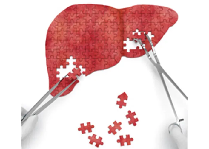 Liver Diseases