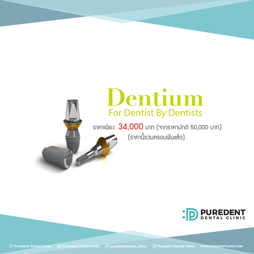 จัดฟันแบบใส Invisalign, Straumann ที่ไหนดีที่สุด