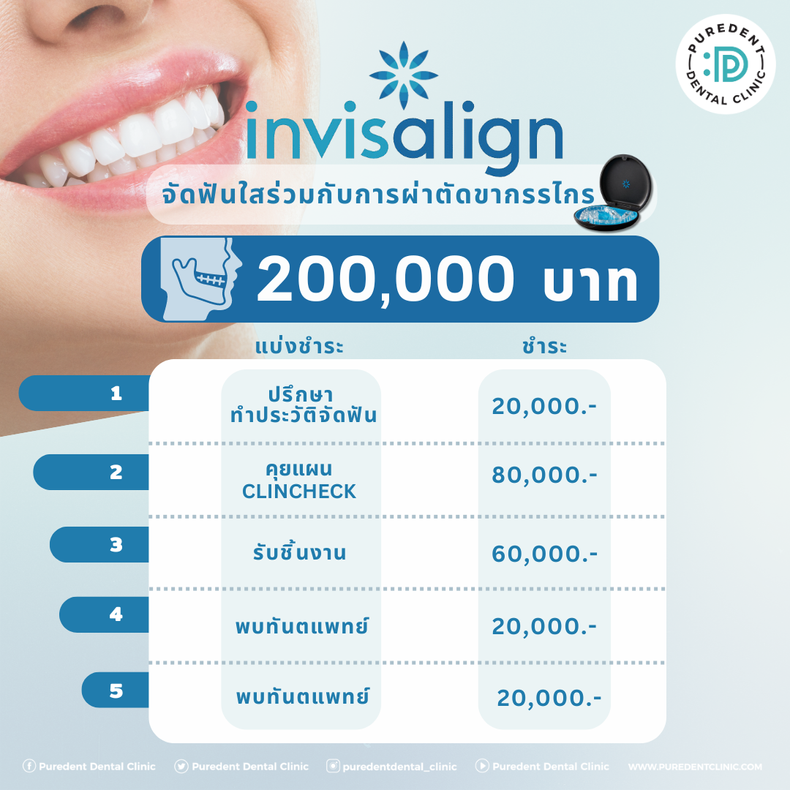 จัดฟันแบบใส