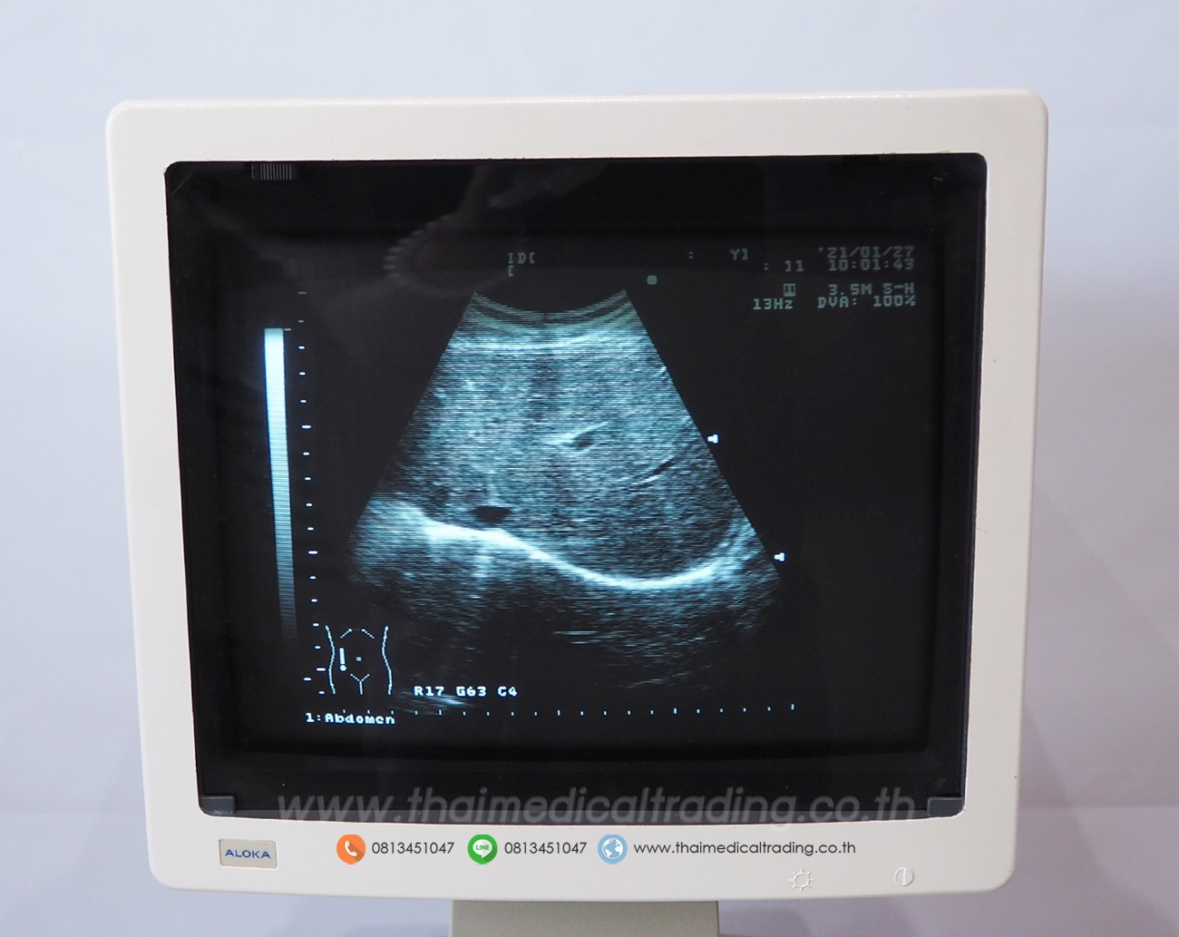 Ultrasound Aloka SSD 1000