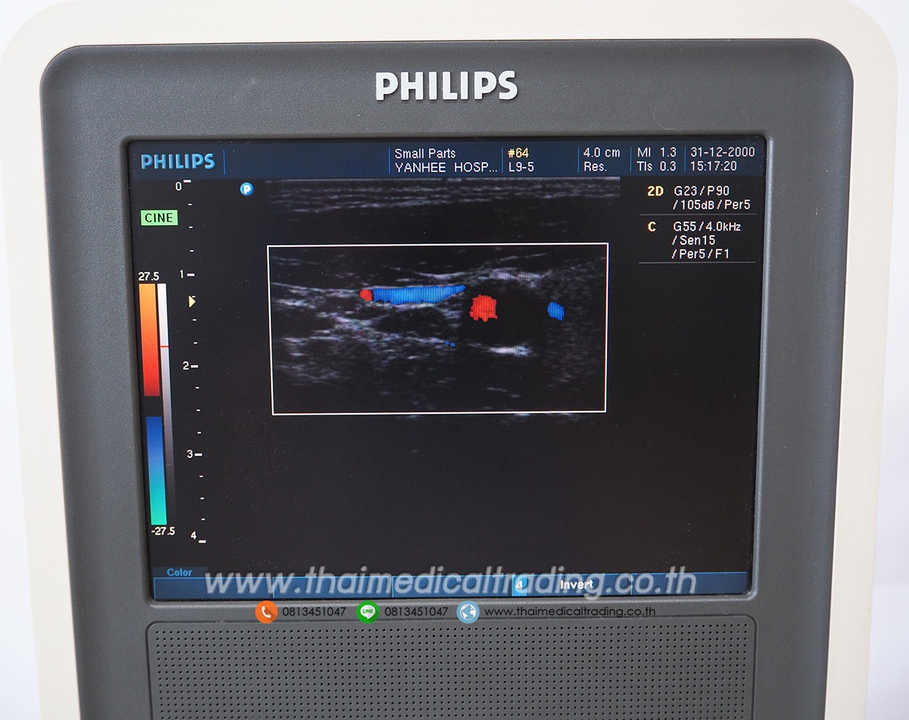 Philips HD 3