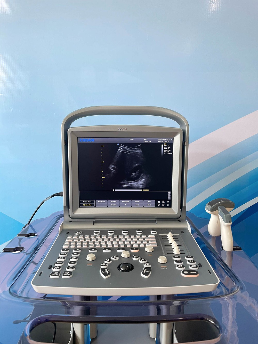 อัลตร้าซาวด์ Chison ECO5