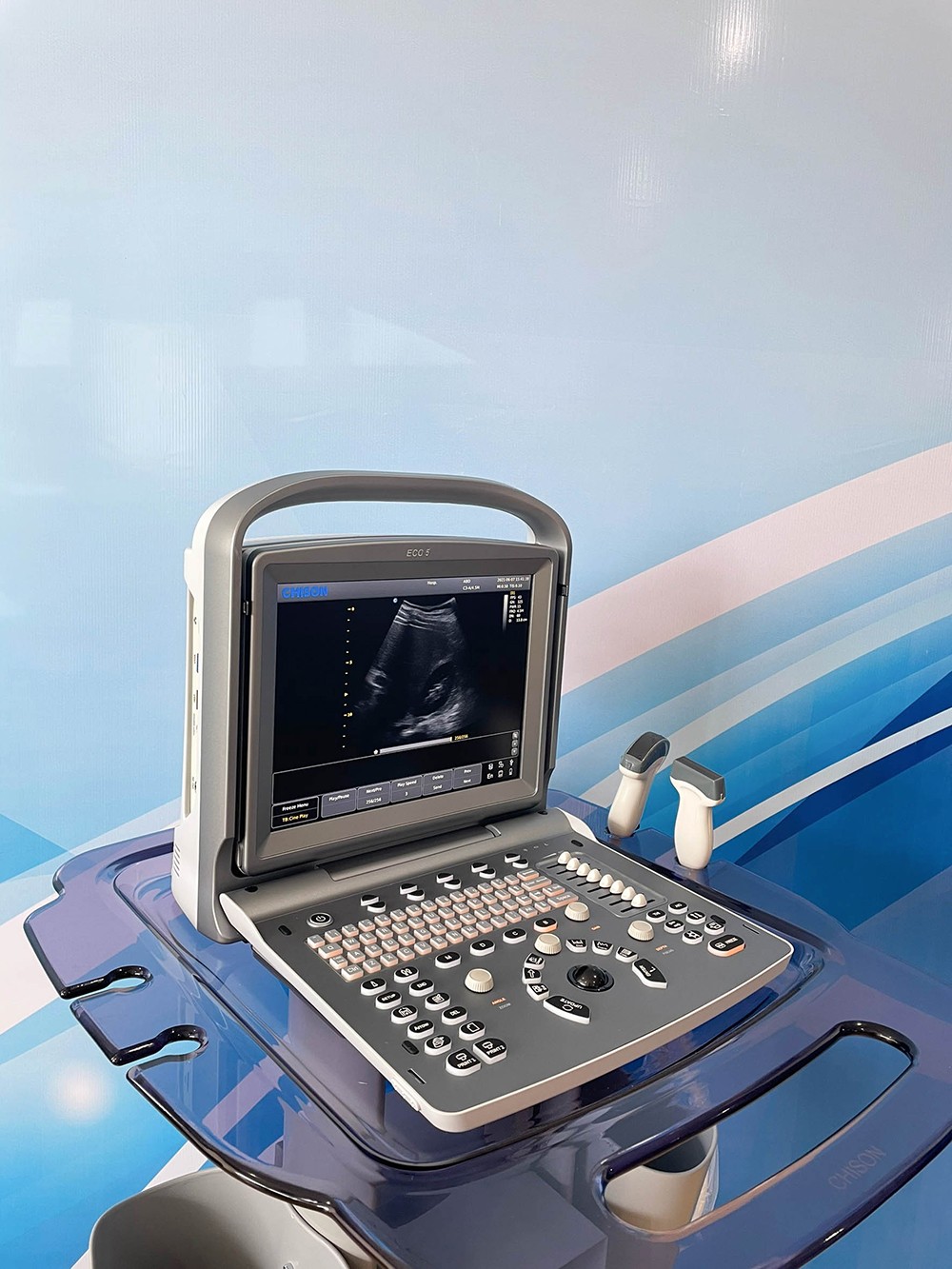 อัลตร้าซาวด์ Chison ECO5