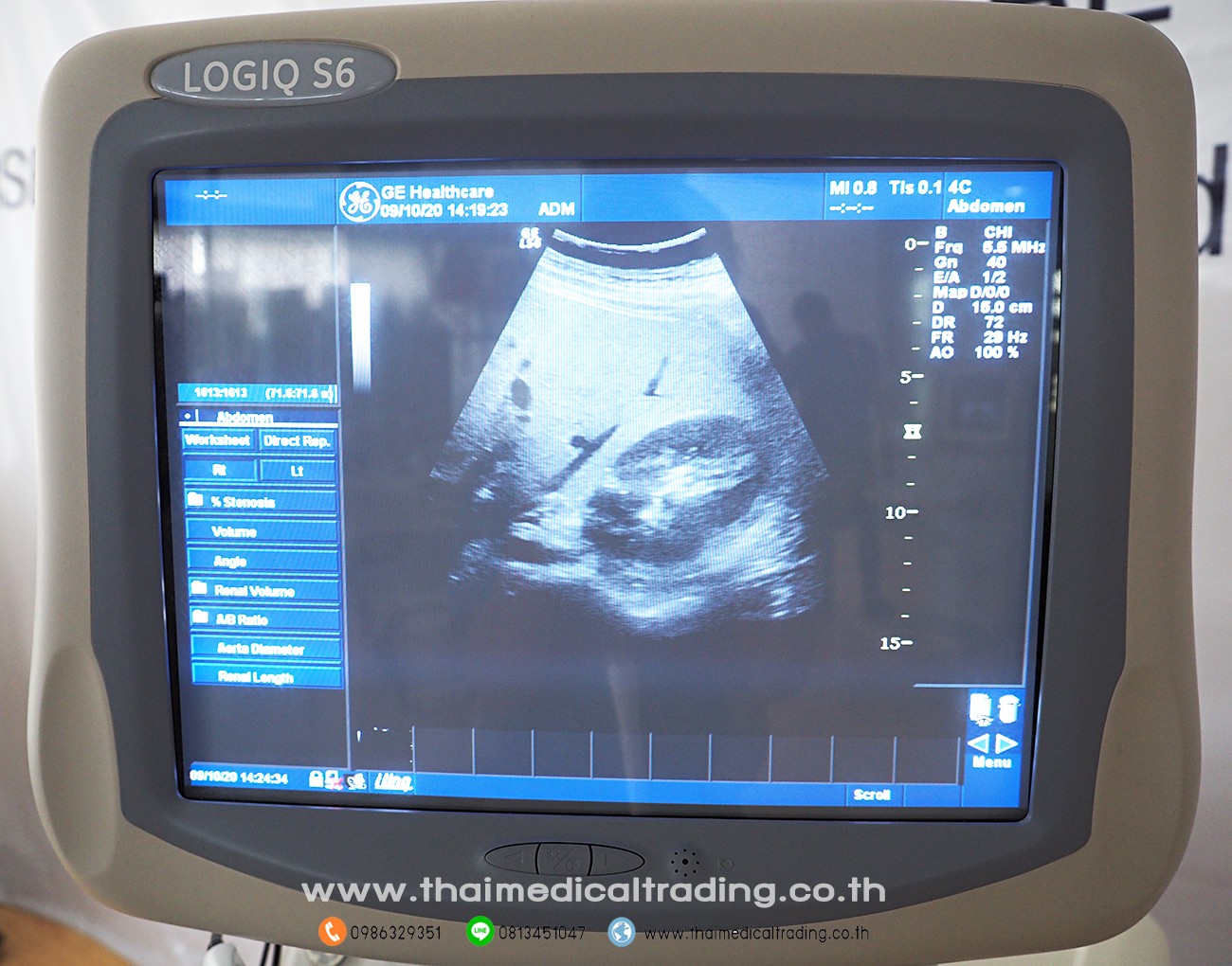 เครื่องอัลตร้าซาวด์ GE Logiq S6