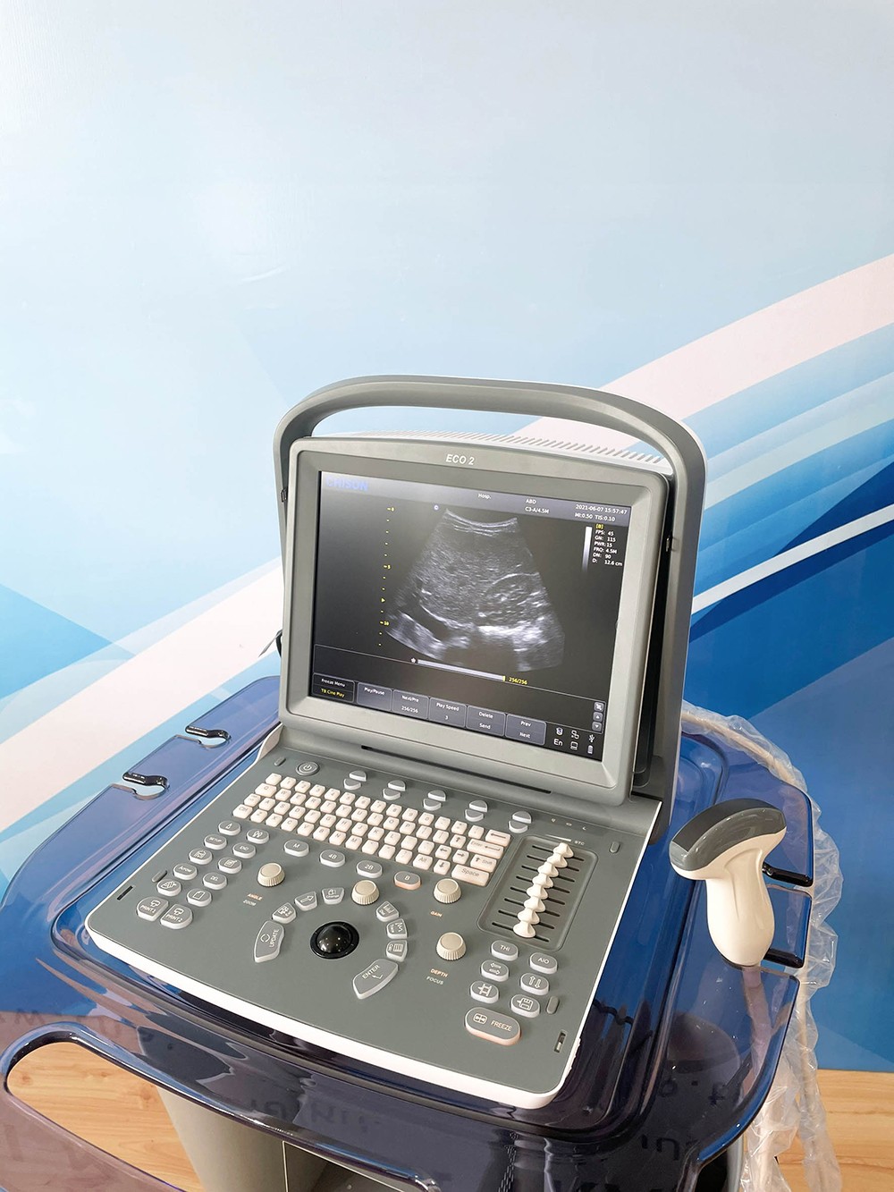 อัลตร้าซาวด์ Chison ECO2
