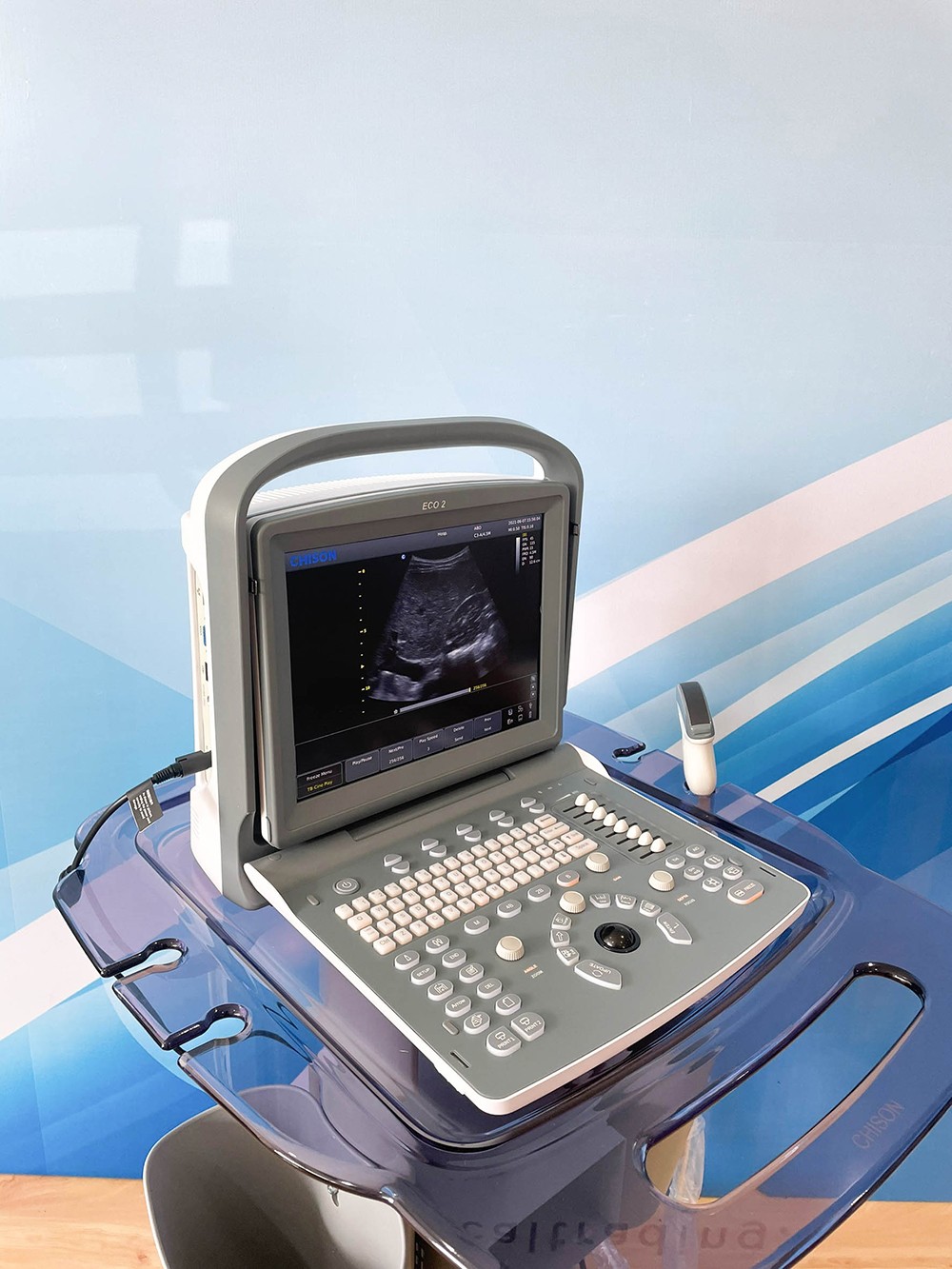 อัลตร้าซาวด์ Chison ECO2