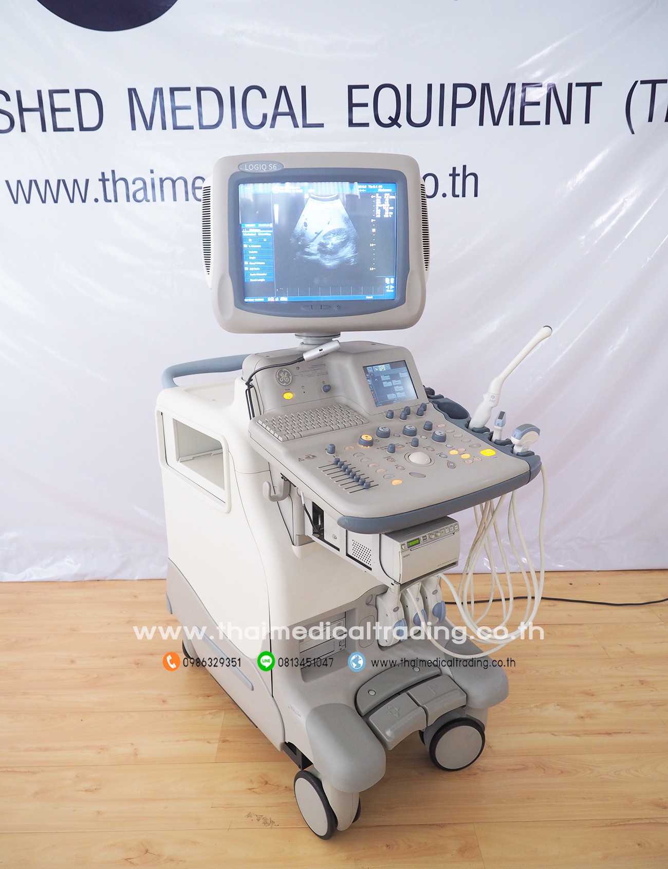 เครื่องอัลตร้าซาวด์ GE Logiq S6