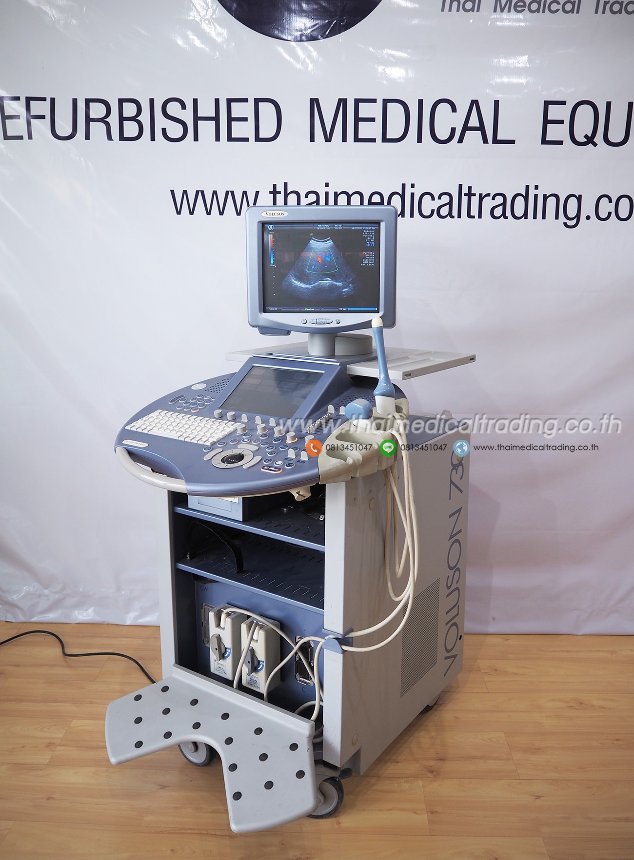 Ultrasound 4D GE Voluson 730 Expert