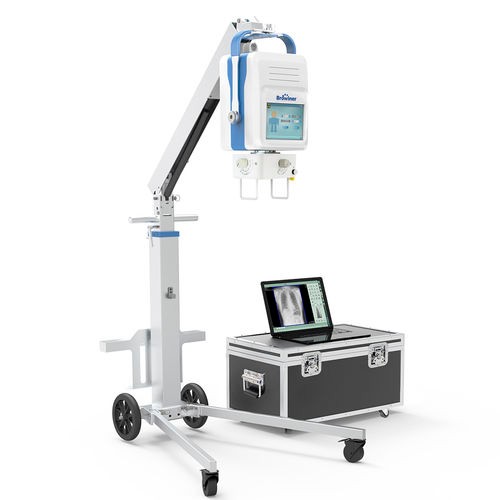 Portable X-Ray
