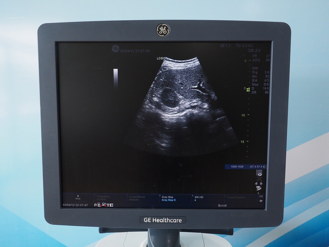 บริการ ขายเครื่องมือแพทย์มือสอง และของใหม่ ประกัน1ปี มีเครื่องสำรอง