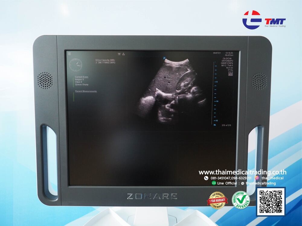 เครื่องอัลตร้าซาวด์ Mindray Zonare Z One Pro