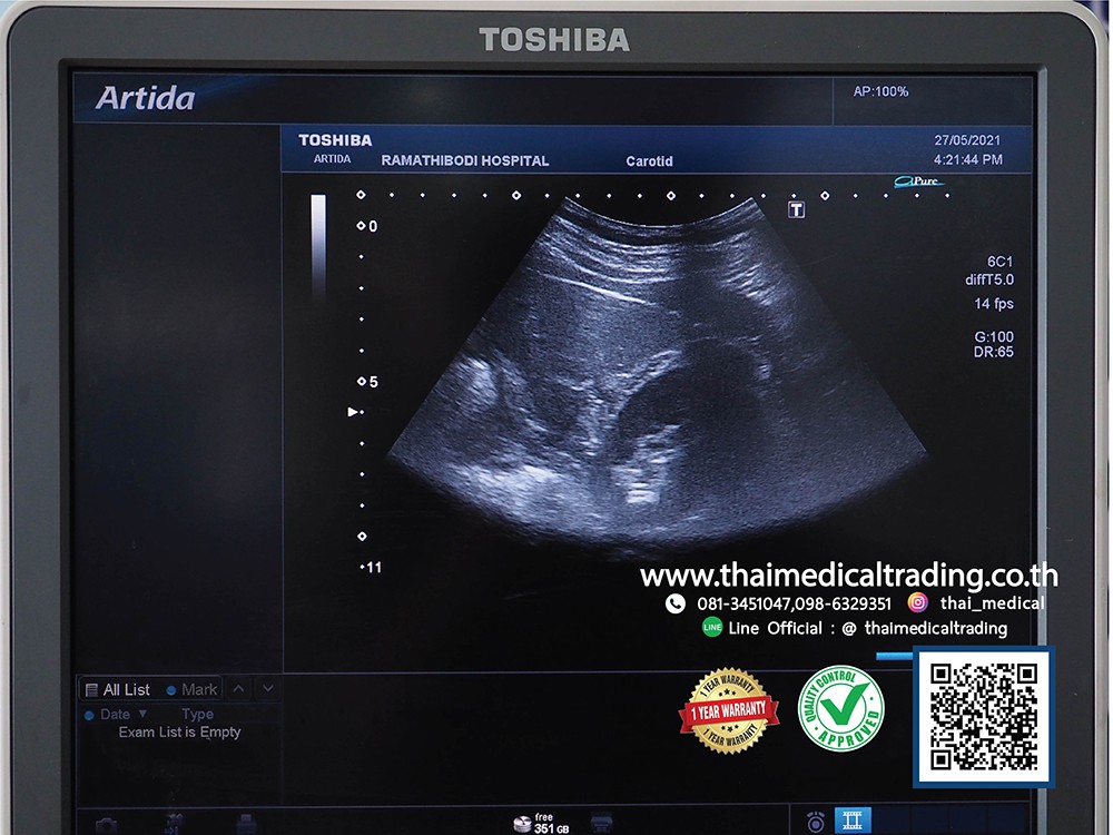 เครื่องอัลตร้าซาวด์ Toshiba Artida