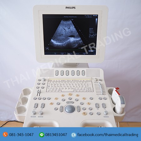อัลตร้าซาวด์ Ultrasound Machine