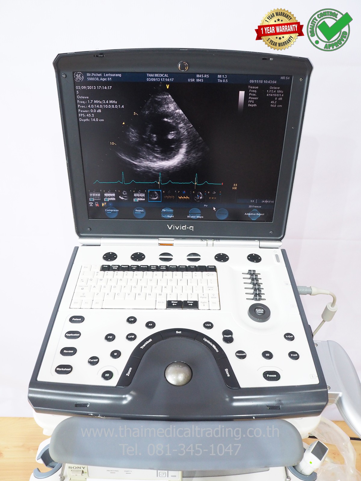 Ultrasound GE Vivid Q