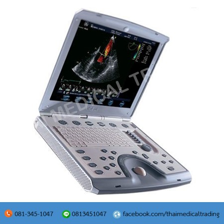 อัลตร้าซาวด์ Ultrasound Machine