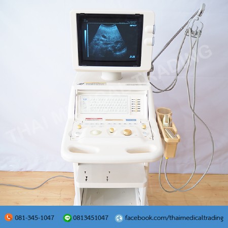 อัลตร้าซาวด์ Ultrasound Machine