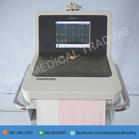 ECG Recorder