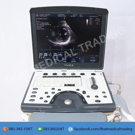 อัลตร้าซาวด์ Ultrasound Machine