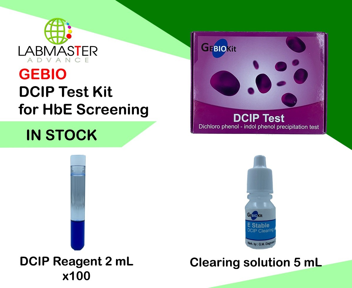 "GEBIO" DCIP test kit