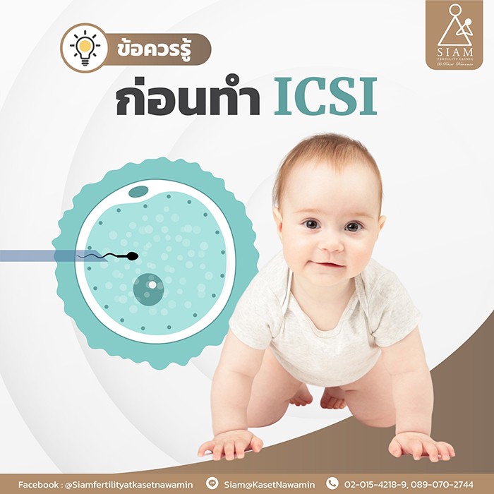 ICSI
