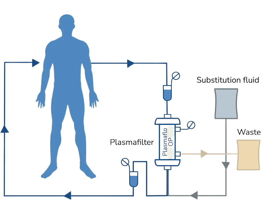 Plasmapheresis คืออะไร? มีผลข้างเคียงไหม | Navella