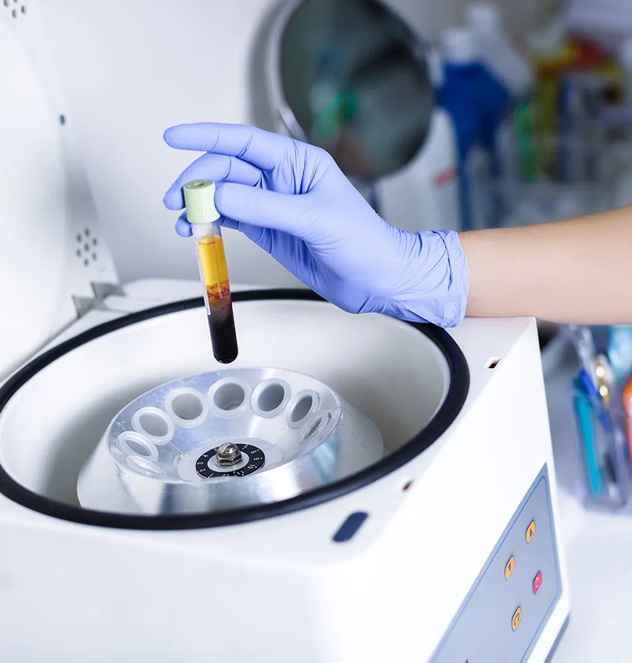 Platelet Rich Plasma (PRP) Therapy