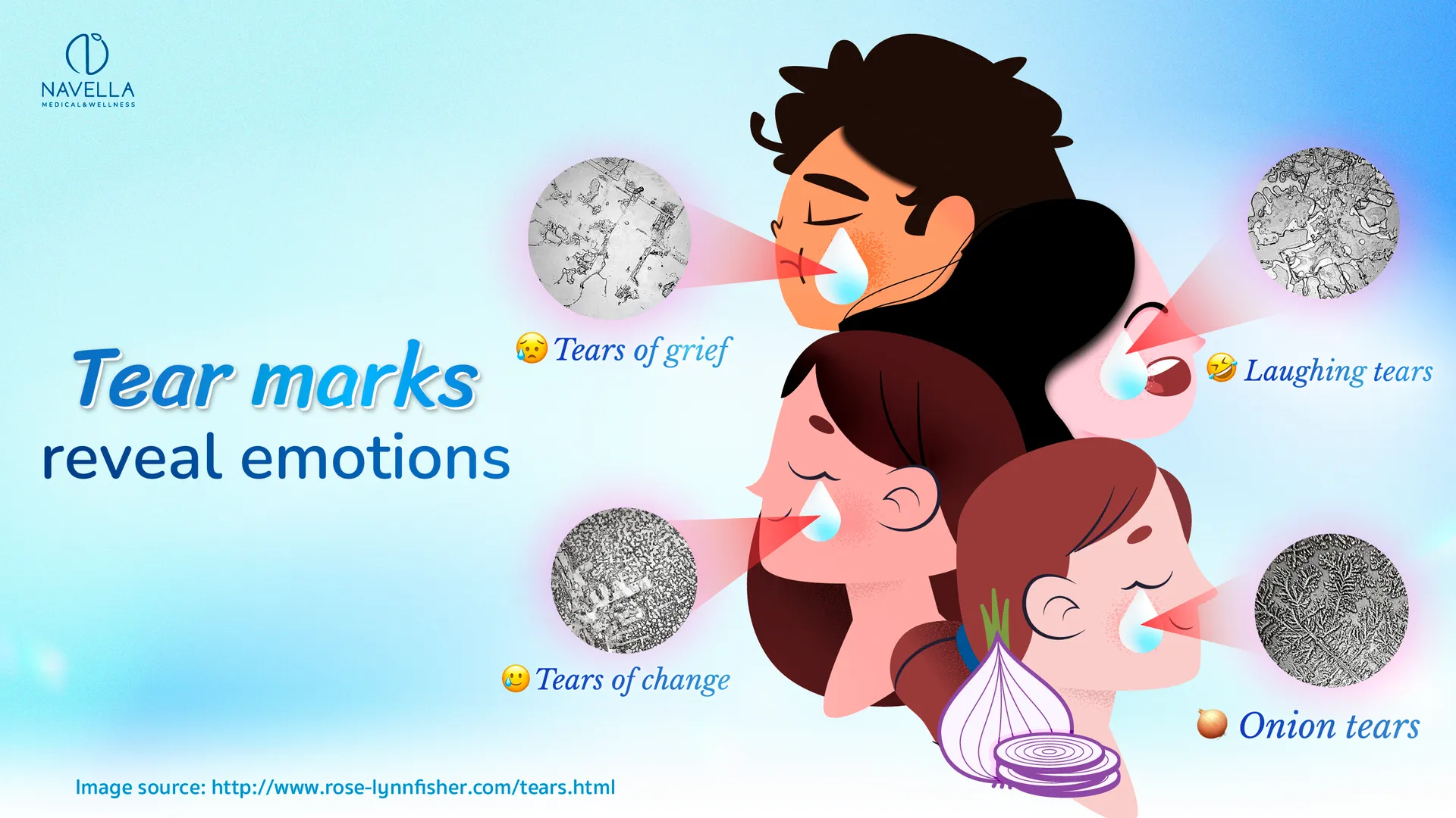 Did You Know? Tear Crystals Reflect Our Physical and Emotional States