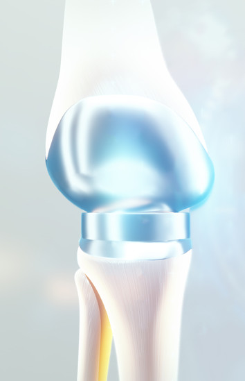 UC-II (ยูซี-ทู) สารสกัดอันดับ 1 บำรุงข้อต่อ กระดูก